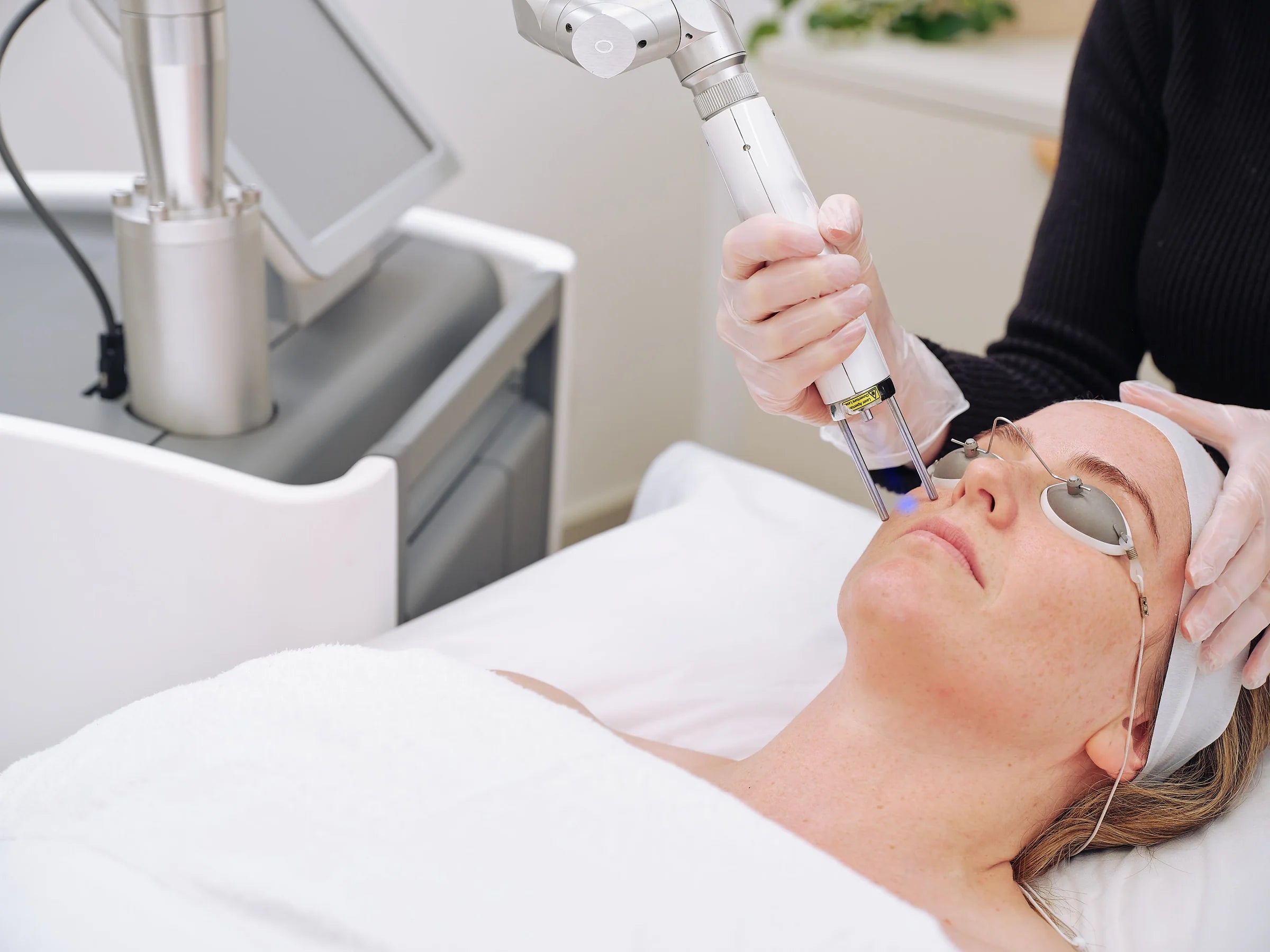 Laser apparatuur – Dermatools